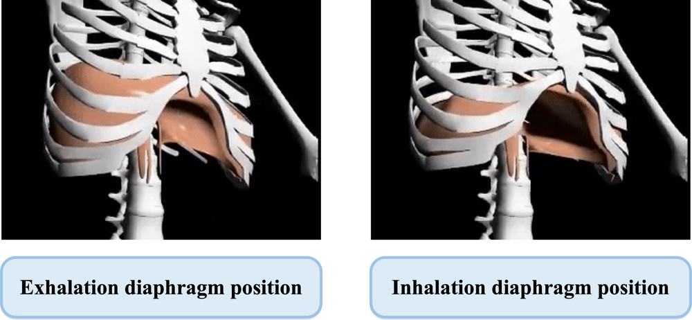 Diaphragm Function Evaluation in COPD Patients Using Chest CT Image ...